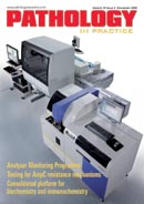 Tosoh and Thermo Fisher launch new automated laboratory analyser system